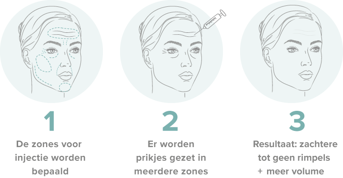 Shape your face with Liquid Facelift Filler | Fillers Gent